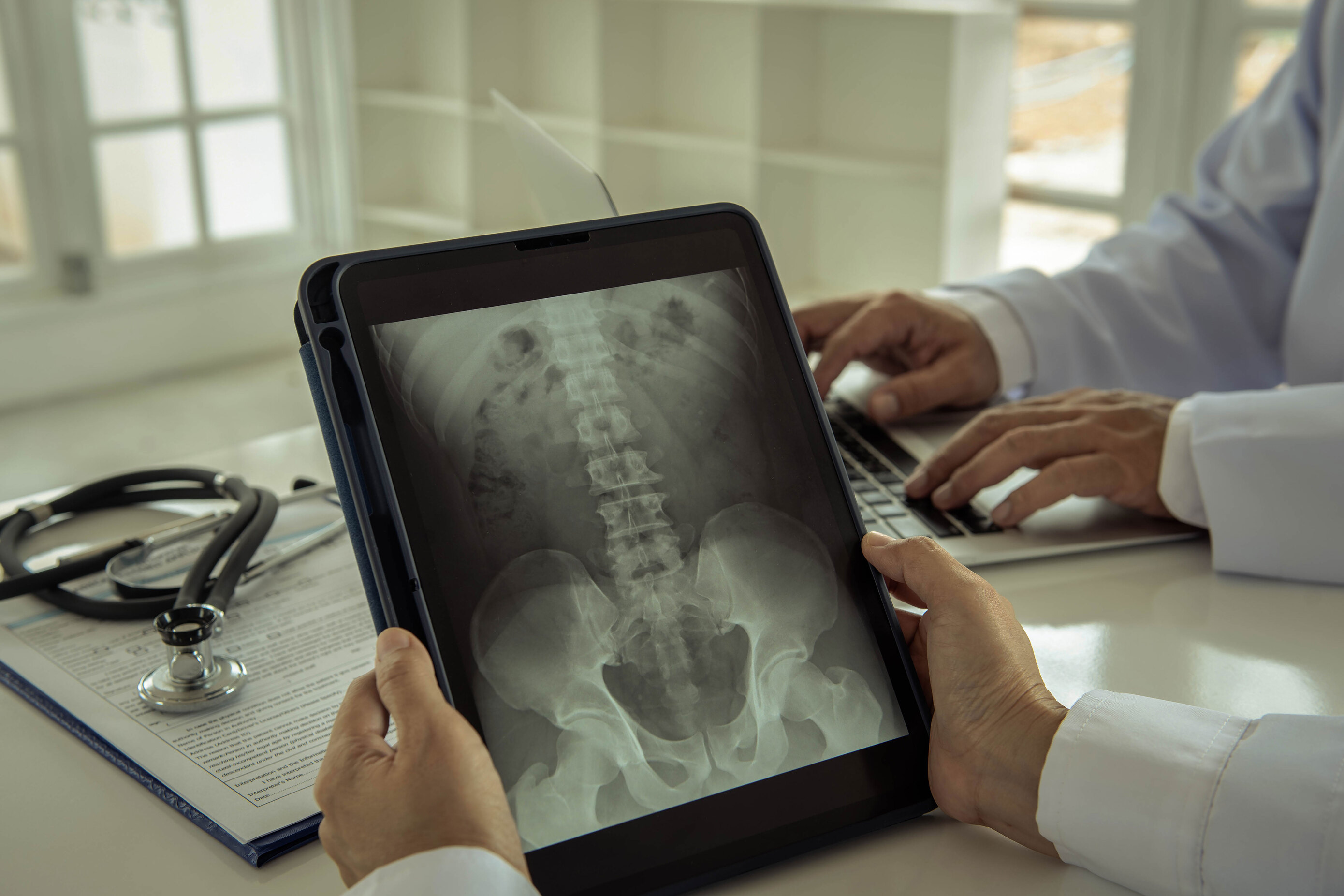 Portable X-Ray System | Vicor